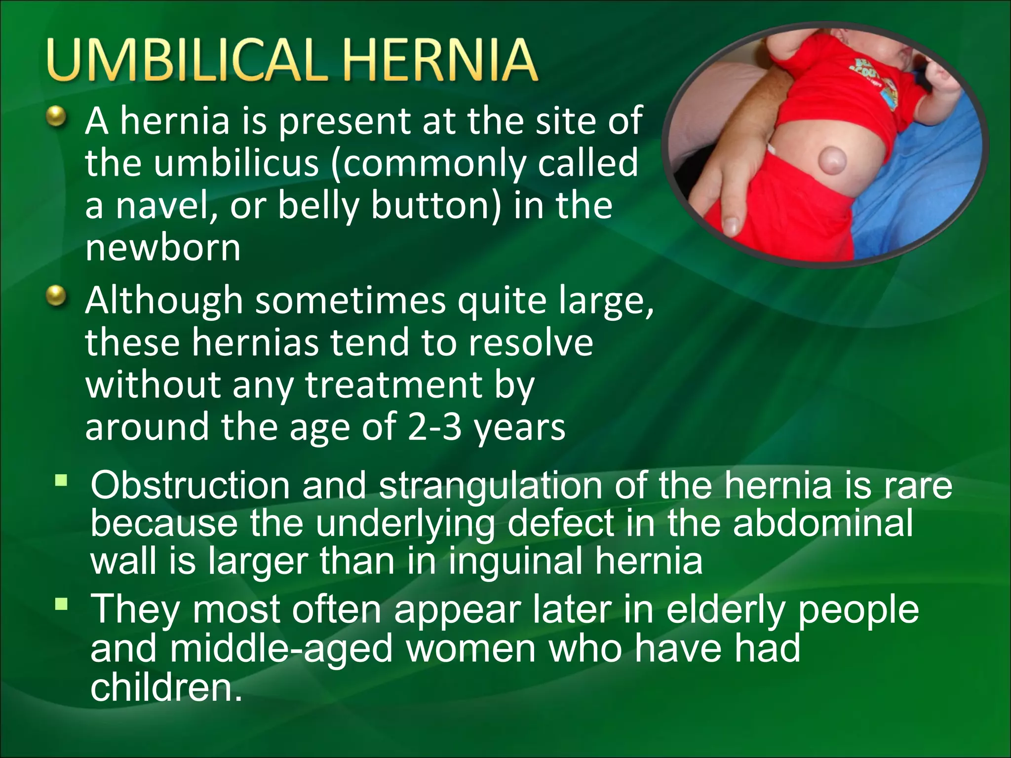 Hernia yashwant kumar. | PPT
