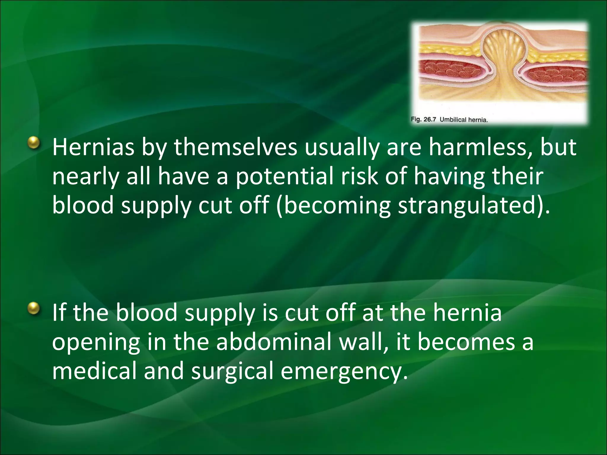Hernia yashwant kumar. | PPT