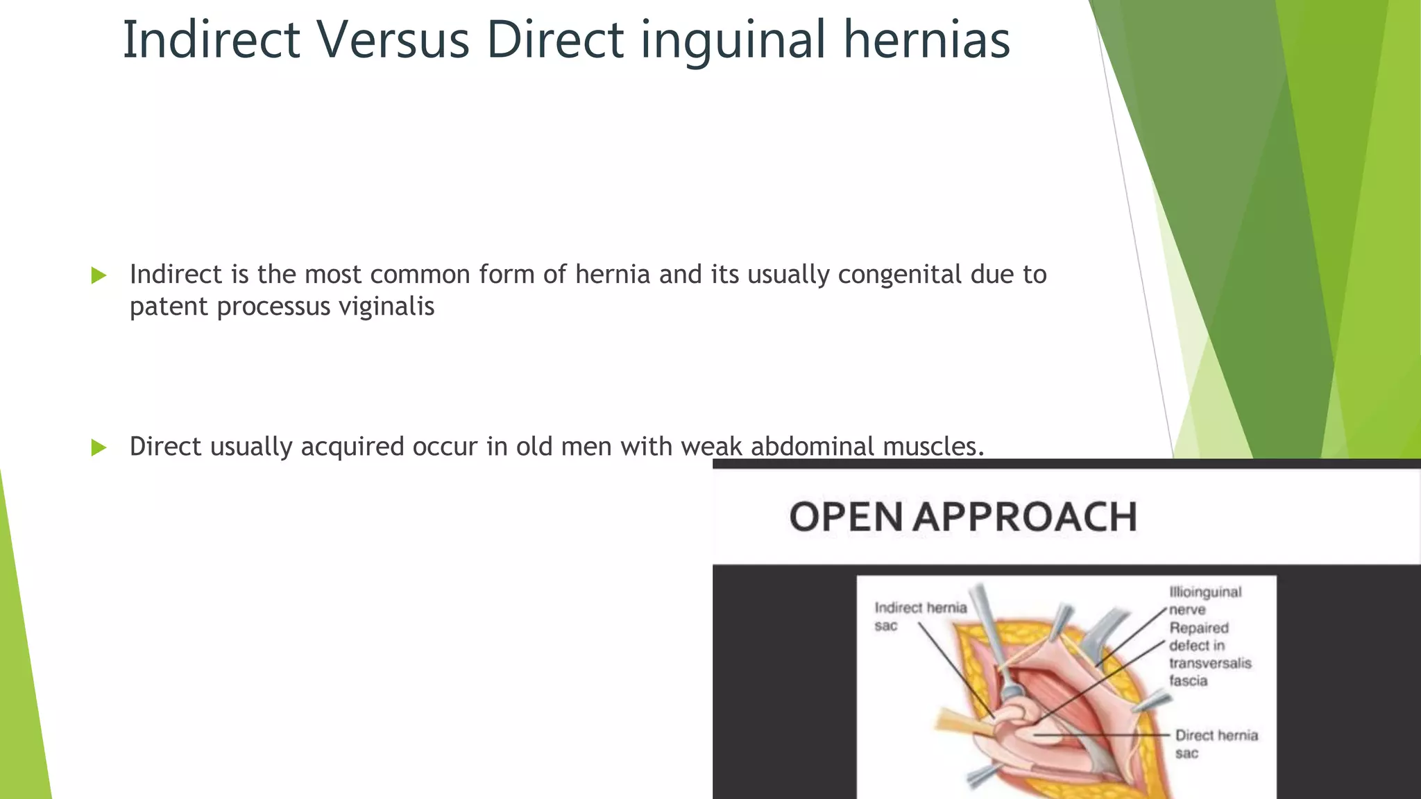 hernia 2 .pptx