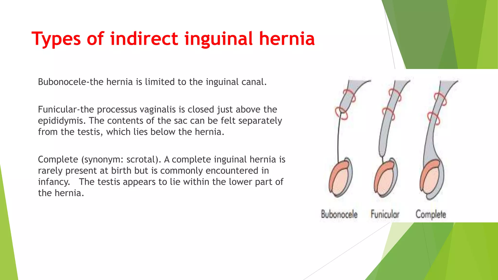 hernia 2 .pptx