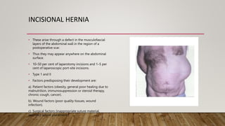 HERNIA 2023.pptx