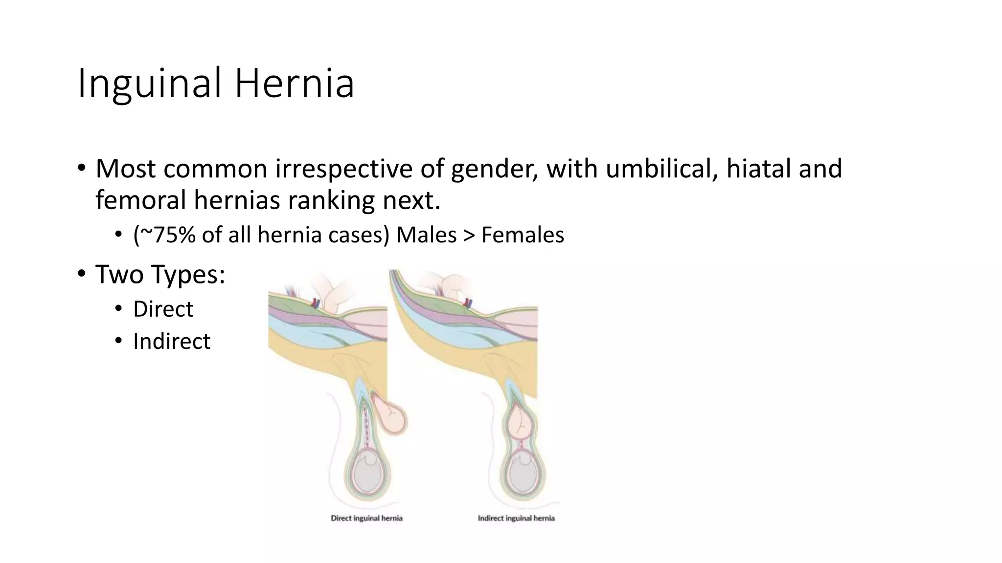 Hernia and Approach to Testicular Pain.pptx