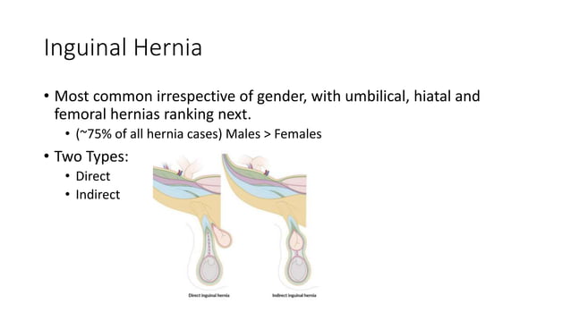 Hernia and Approach to Testicular Pain.pptx