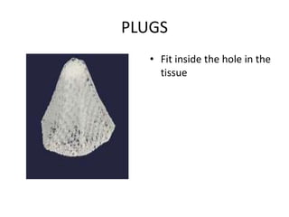 Hernia and its repair | PPTX