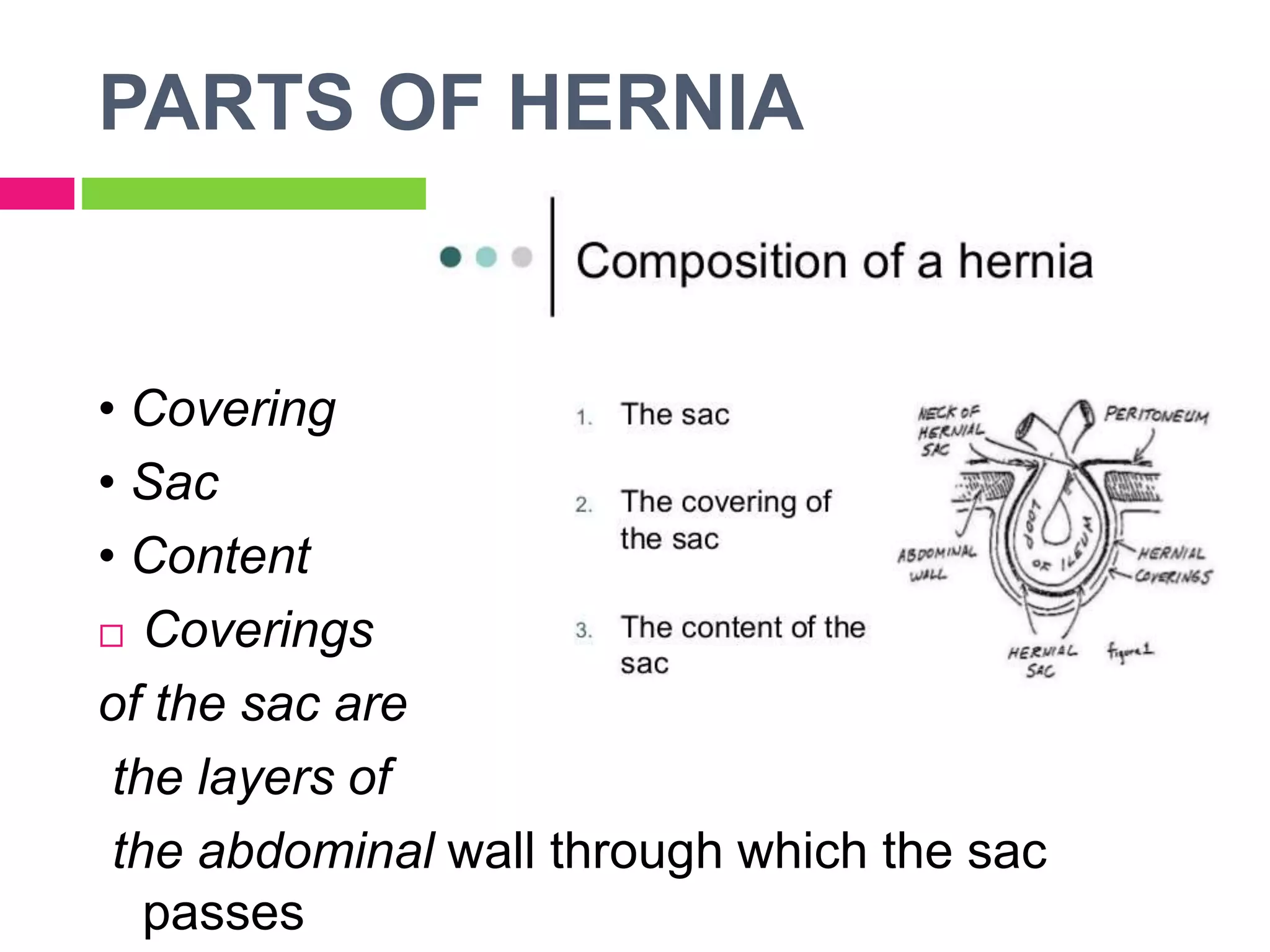 Hernia | PPTX