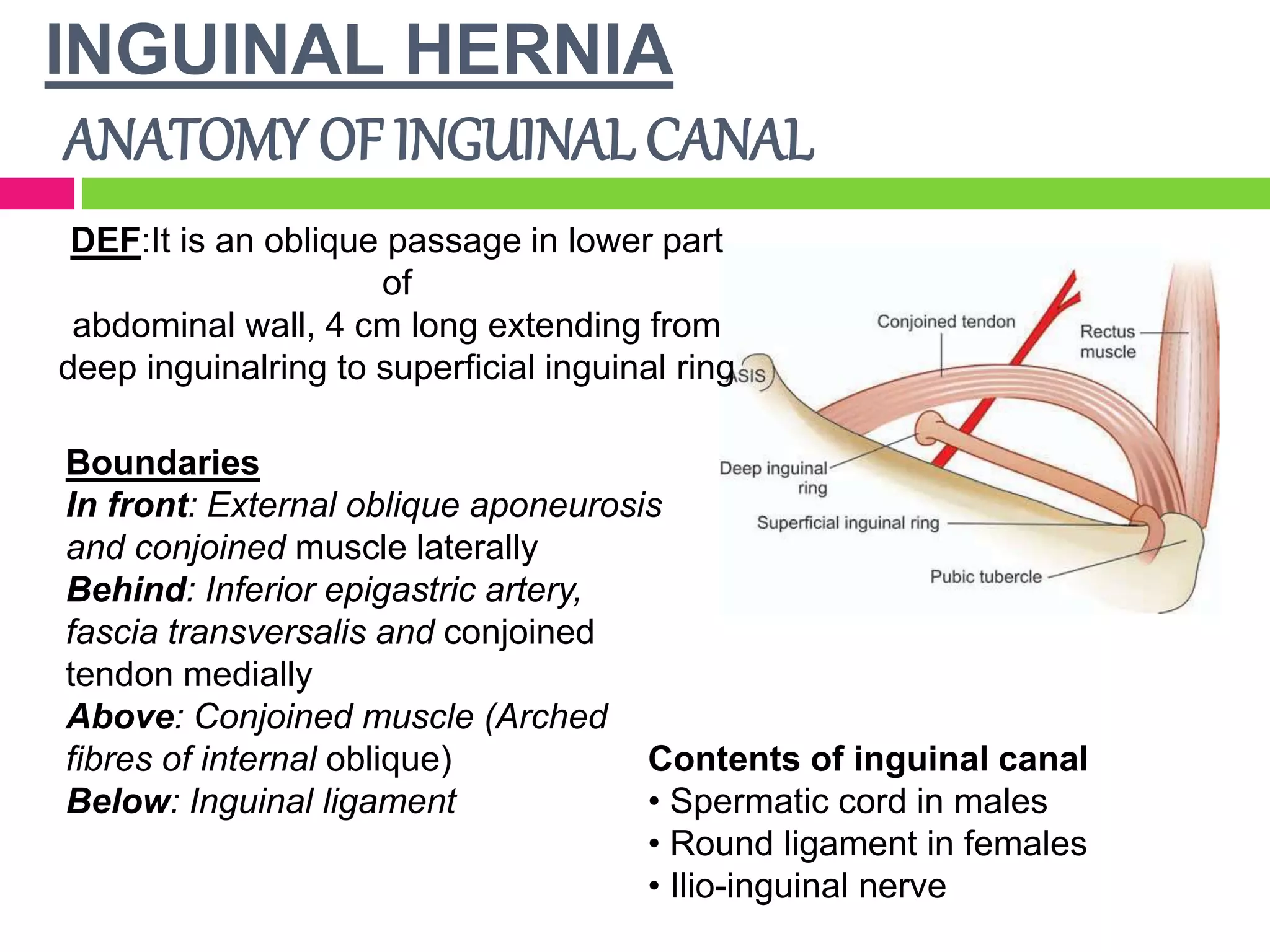 Hernia | PPTX