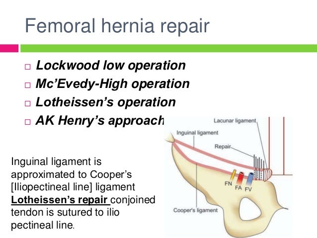 Hernia