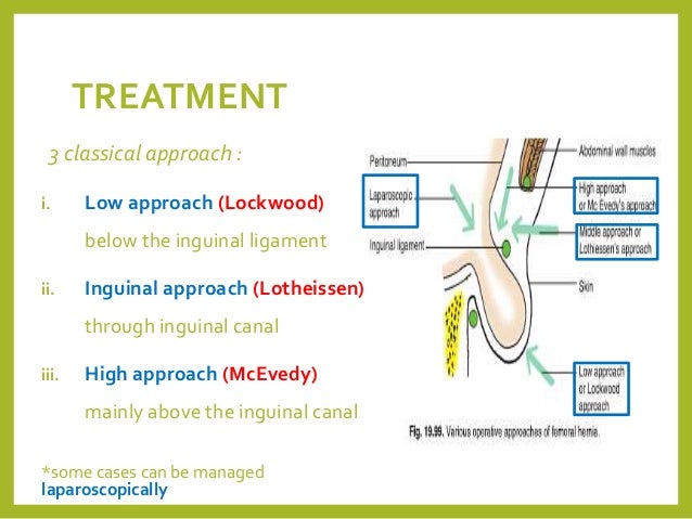 HERNIA (FEMORAL & UMBILICAL)