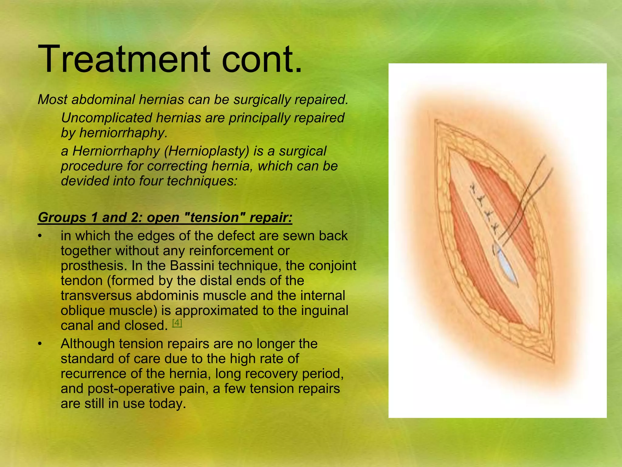 Hernia | PPT