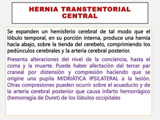 herniacioncerebral- interpretacion tomografica | PPTX