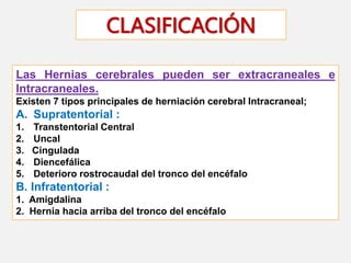 herniacioncerebral- interpretacion tomografica | PPTX