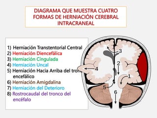 herniacioncerebral- interpretacion tomografica | PPTX