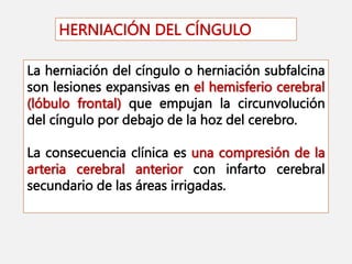 herniacioncerebral- interpretacion tomografica | PPTX
