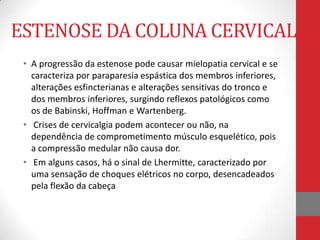 Hernia de Disco e Estenose de Canal | PPTX