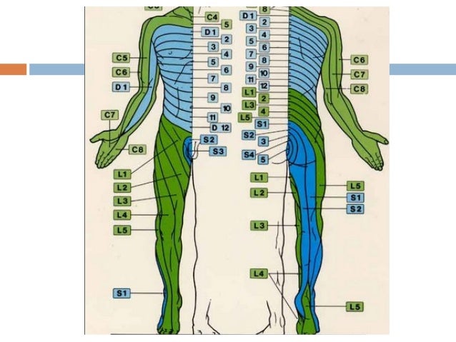 Hernia de disco lumbar