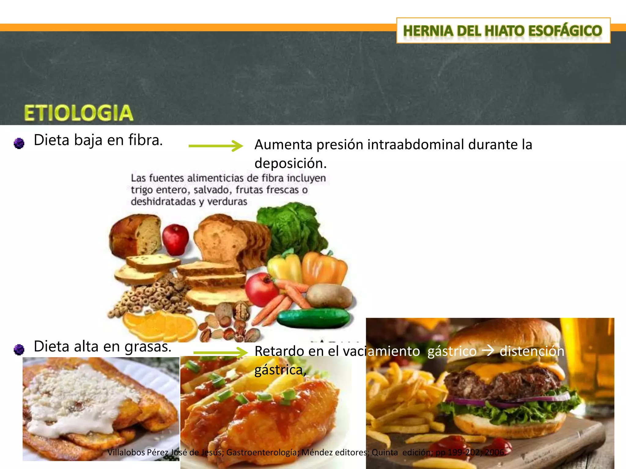 Hernia del hiato esofagico 2 | PPT