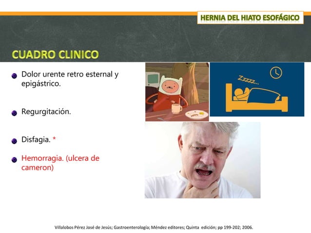 Hernia del hiato esofagico 2 | PPT
