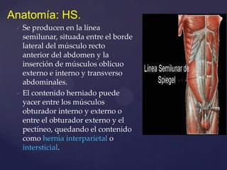 Hernia de spiegel | PPTX