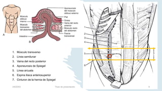 ESPECIALES Hernia de Spiegel, de Petit y de.pptx