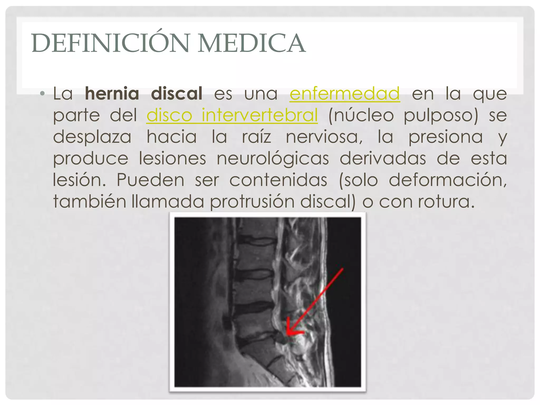 Hernia discal | PPT