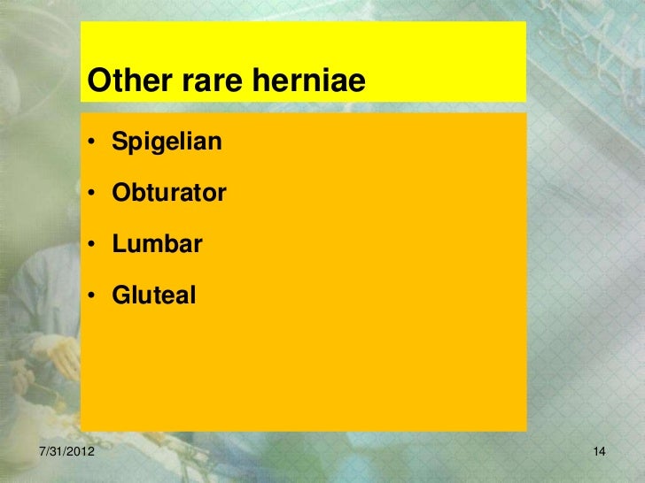 Hernia Examination By Dr Min Oo