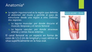 Hernia femoral | PPTX