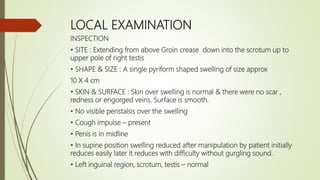 Indirect Inguinal Hernia Exam