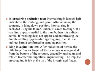 Inguinal Hernia .pptx