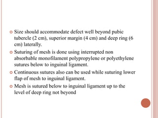 Inguinal Hernia .pptx