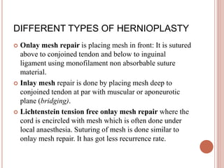 Inguinal Hernia .pptx