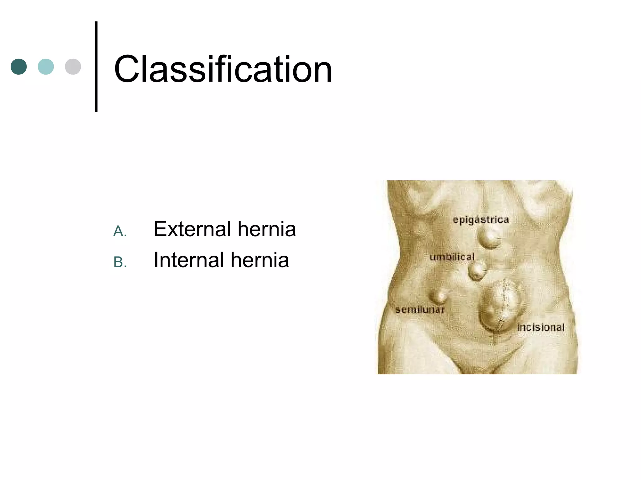 Hernia | PPT