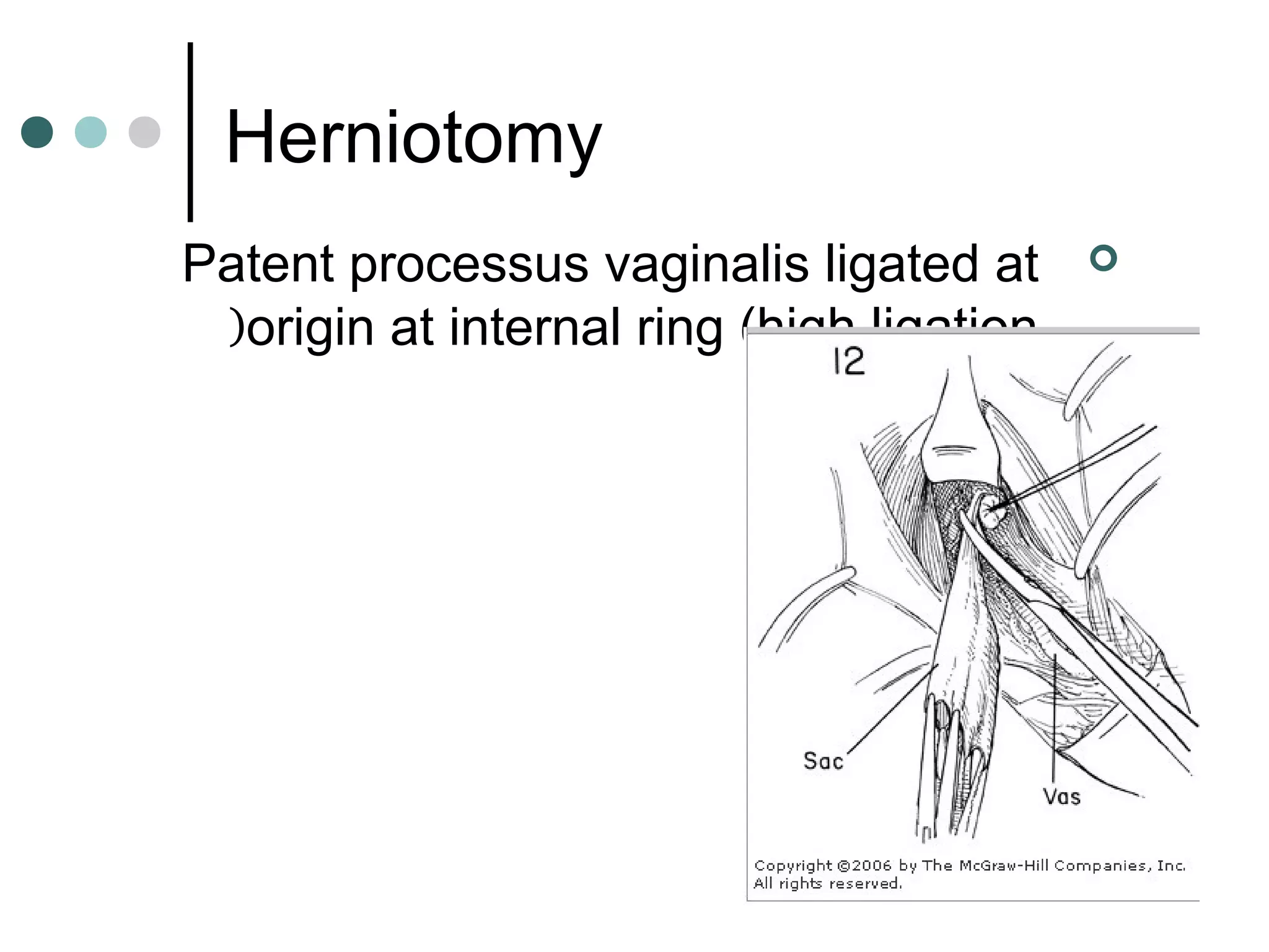 Hernia | PPT