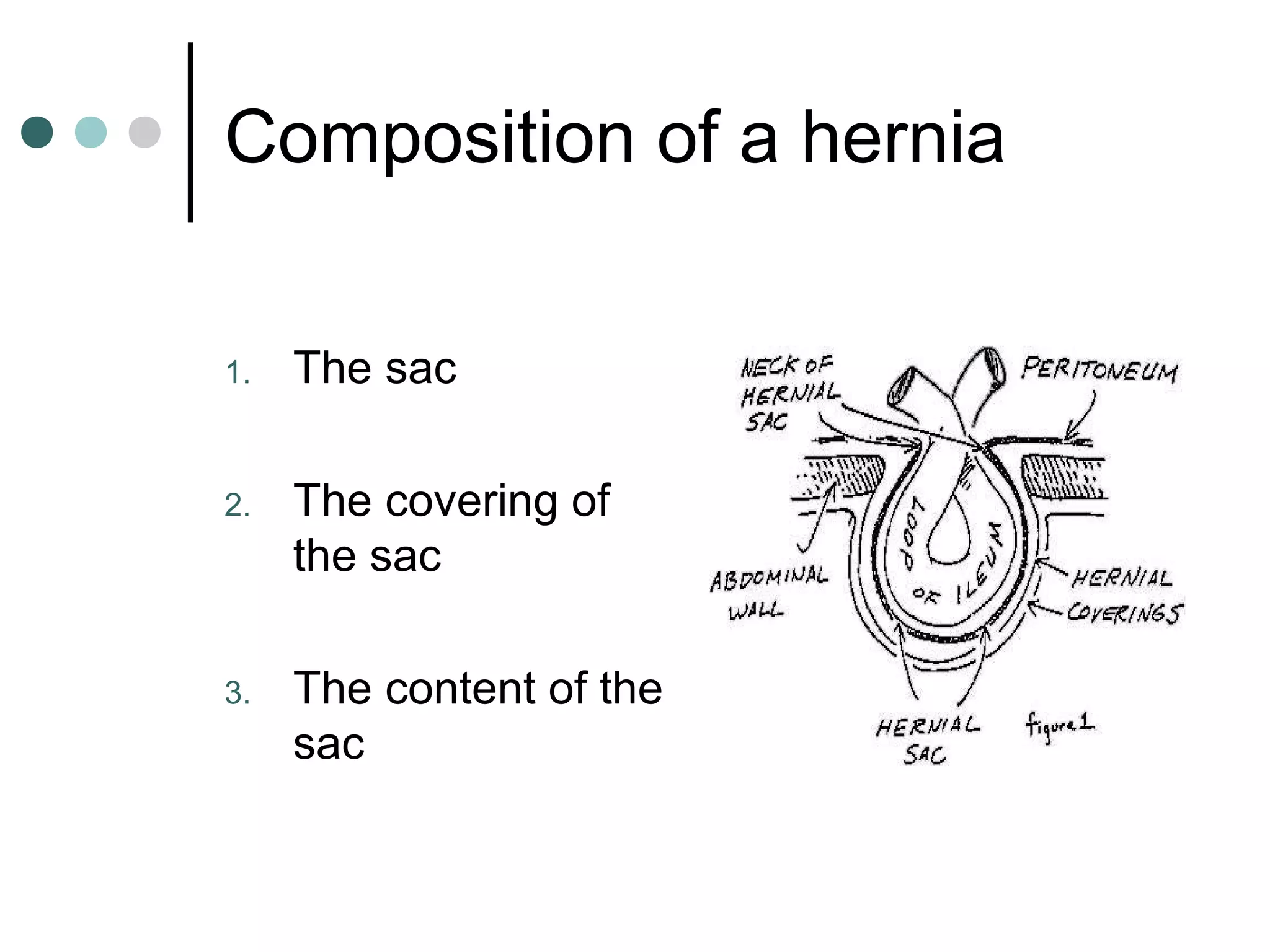 Hernia | PPT