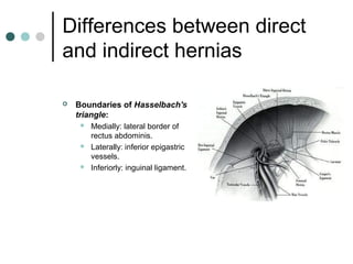 Hernia | PPT