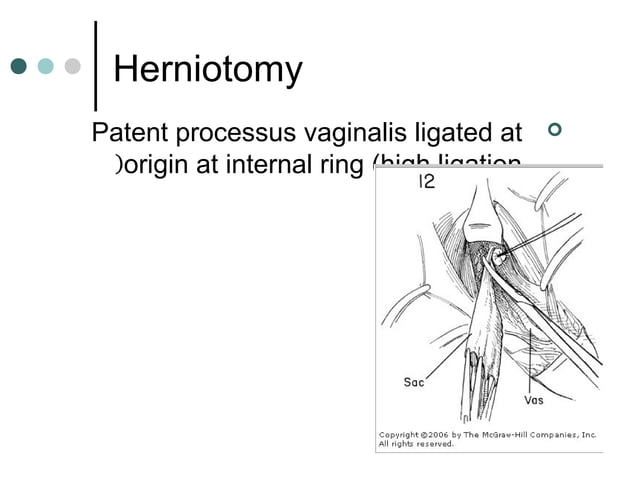 Hernia | PPT