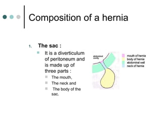 Hernia | PPT