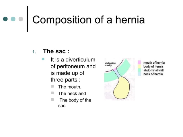 Hernia | PPT