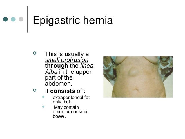 Hernia