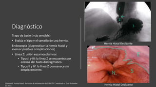 Hernia Hiatal de Anfernee.pptx