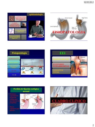 Hernia hiatal, esofagitis y erge | PDF
