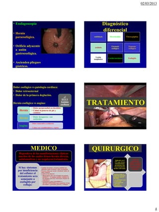 Hernia hiatal, esofagitis y erge | PDF