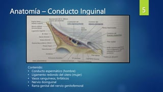 Hernia Inguinal.pptx