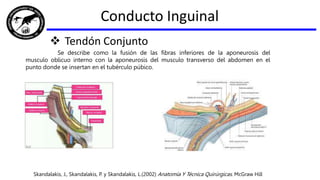 Hernia Inguinaljkkkkkllkklllllklkkkkk.pptx