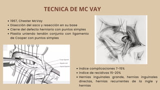 HERNIA INGUINAL, y sus estructuras ayacentes | PDF