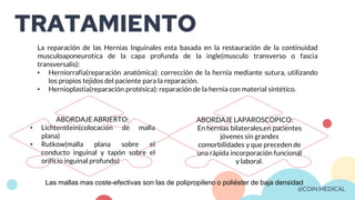 HERNIA INGUINAL | PDF