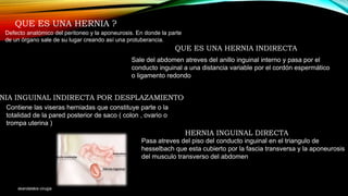 HERNIA INGUINAL Y SU ABORDAJE QUIRURGICO | PPTX