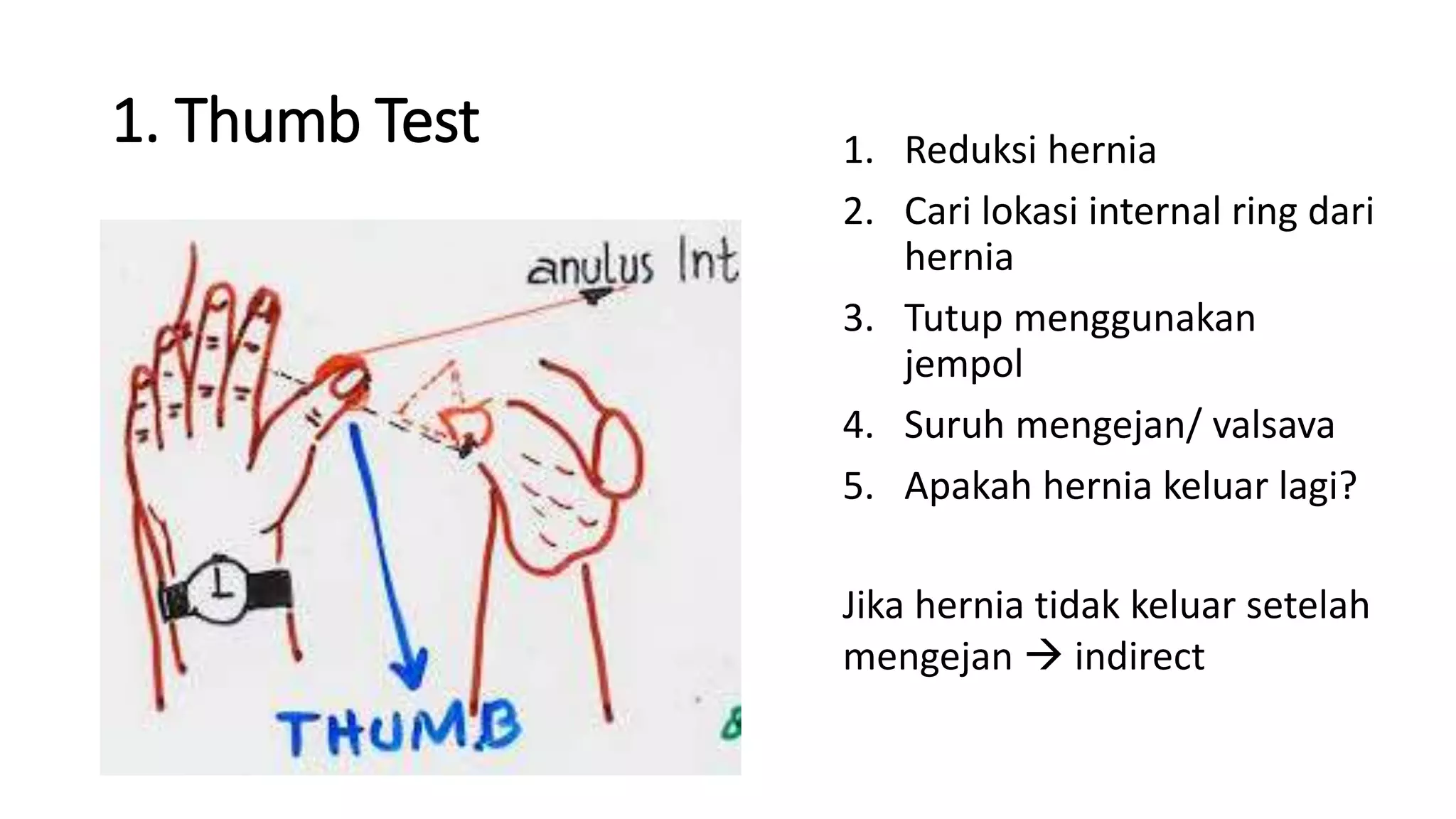 Hernia Inguinalis.pptx