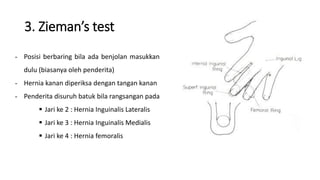 Hernia Inguinalis.pptx