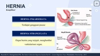 Hernia Inguinalis dan Hidrokel pada Anak | PPTX