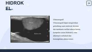 Hernia Inguinalis dan Hidrokel pada Anak | PPTX